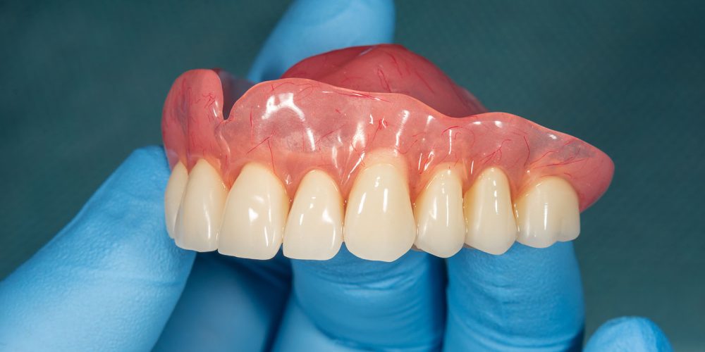 Dentures | The Dental Centre Oakdale | Restore Your Smile