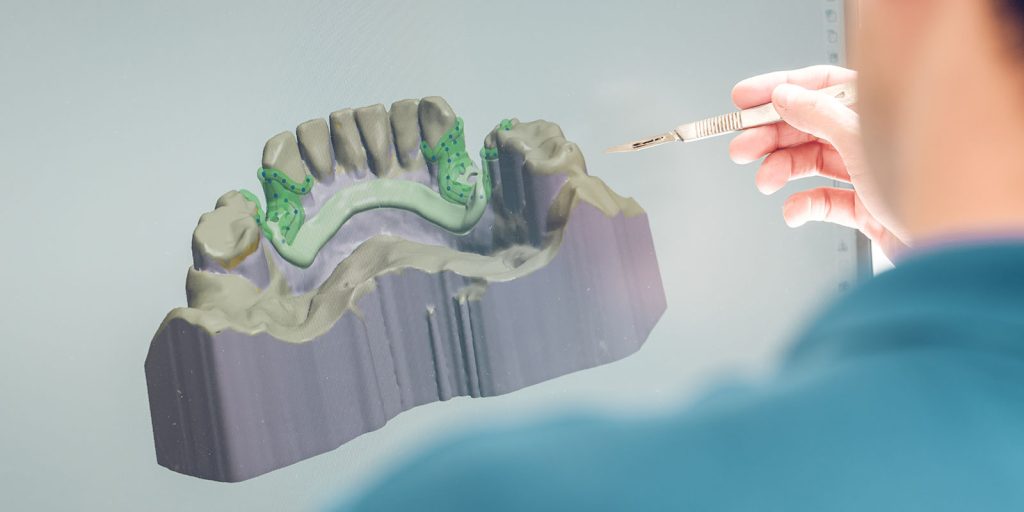 Dentures | The Dental Centre Oakdale | Restore Your Smile