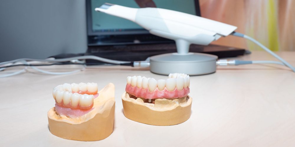 Dentures | The Dental Centre Oakdale | Restore Your Smile